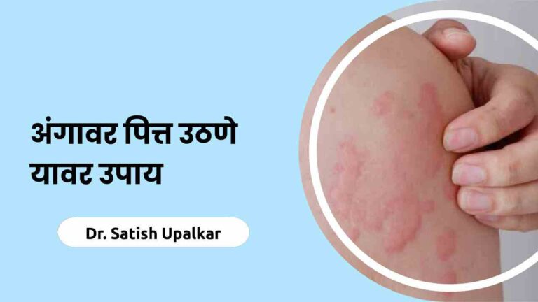 अंगावर पित्त उठण्याची कारणे व उपाय by Dr Satish Upalkar