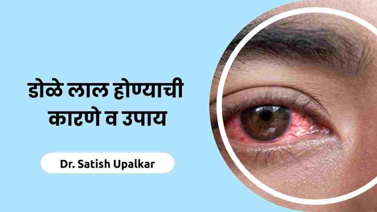 डोळे लाल होणे याची कारणे व उपाय - Dr Satish Upalkar