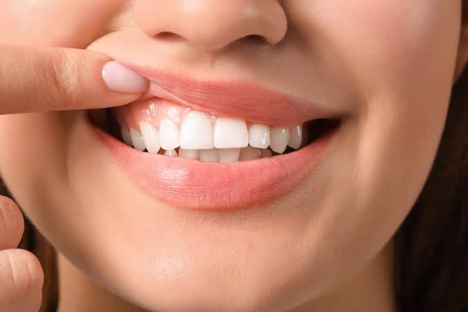 आपल्या दातांची काळजी अशी घ्यावी : Dental Care - Health Marathi